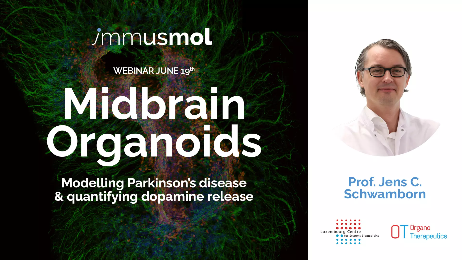 Dopamine quantification: a webinar on midbrain organoid models of ...
